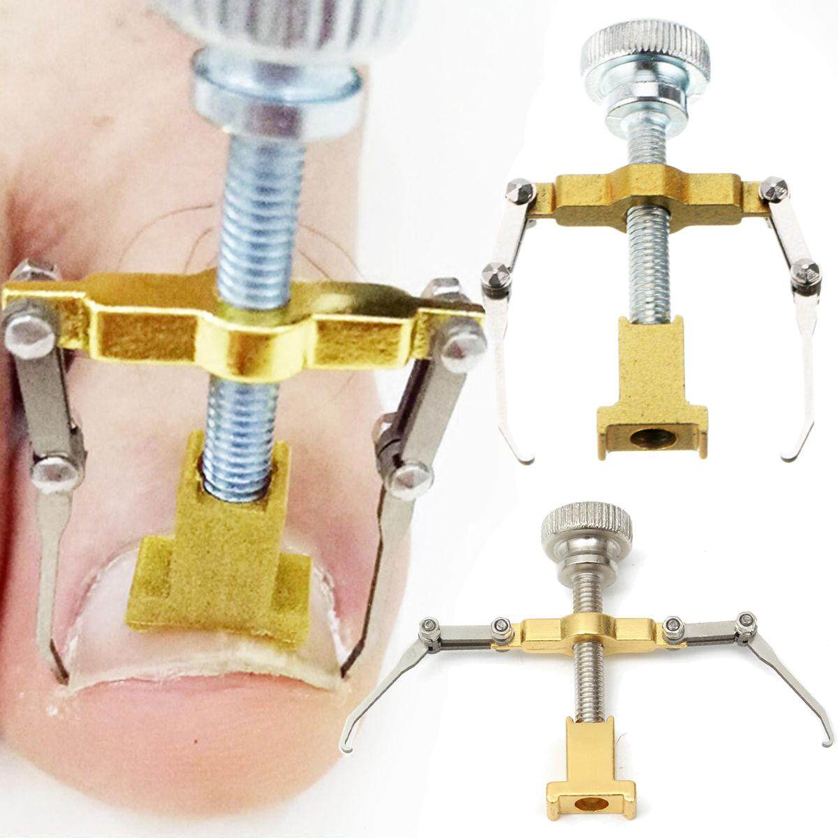 Fijador de uñas del dedo pie encarnado Pedicura Recuperación GENERICO ...