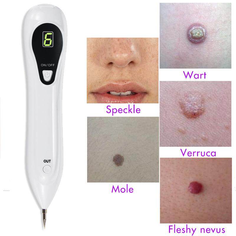 Generic LED Laser Skin Tag Removal Pen Skin Mole Dark Spot Face Wart ...